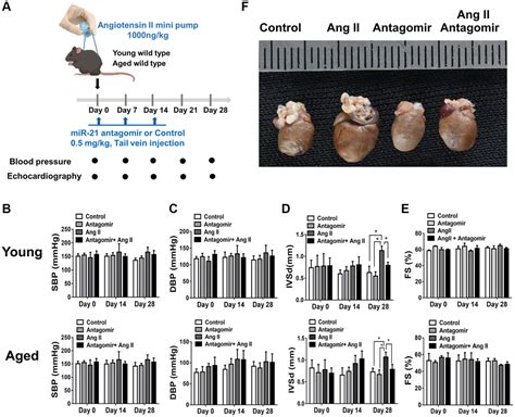 Mir 21 Upregulation Exacerbates Pressure Overload Induced Cardiac