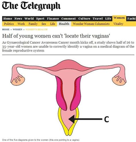 Vaginal Varicose Veins During Pregnancy