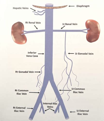 Ch 26 Ivc And Iliac Veins Flashcards Quizlet