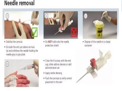 Iv Cannulationppt
