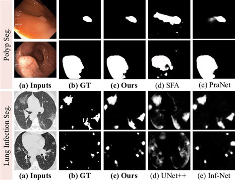 Qualitative Comparison Among Four Cutting Edge Methods Sfa [72] Download Scientific Diagram
