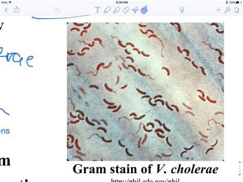 Vibrio Cholerae Gram Stain