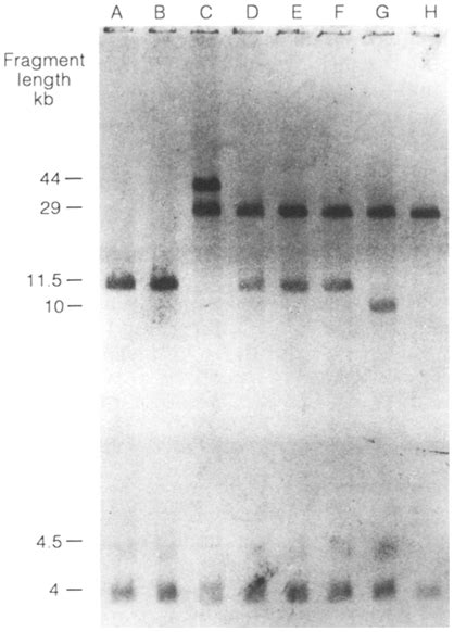 Restriction Fragment Length Patterns Obtained Following Digestion Of Download Scientific