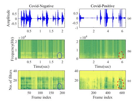 Comparison Of Spectral Energy Densities Of Traditional Stft Spectrogram