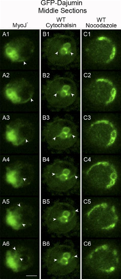 Cv Membrane Dynamics In Myoj Null Cells And In Wt Cells Depleted Of