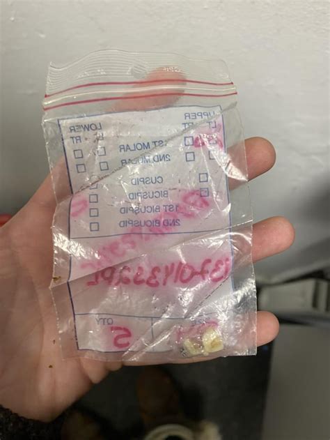 I Found A Tooth In A Jacket I Tried On At The Thrift Shop R