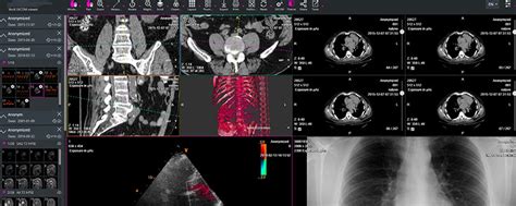 Steps In Building A Dicom Viewer Using Html5 And Javascript The