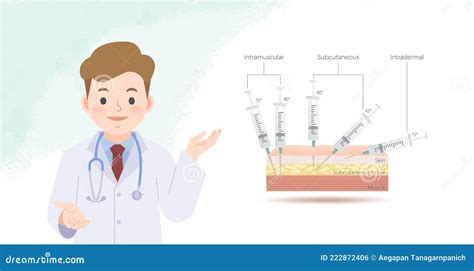 Intradermal And Subcutaneous Injection Vector Illustration 79997650