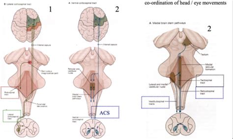 Module 4 Lecture 21 Flashcards Quizlet