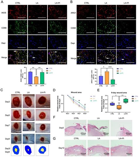 【派森诺项目文章】if10 75！pkm2乳酸化修饰抑制促炎巨噬细胞的炎症代谢适应 知乎
