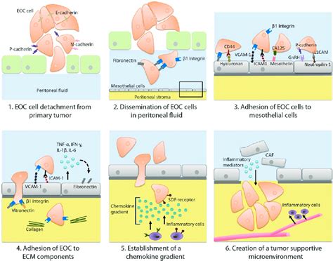 Development Of Peritoneal Metastasis Of Epithelial Ovarian Carcinoma Download Scientific