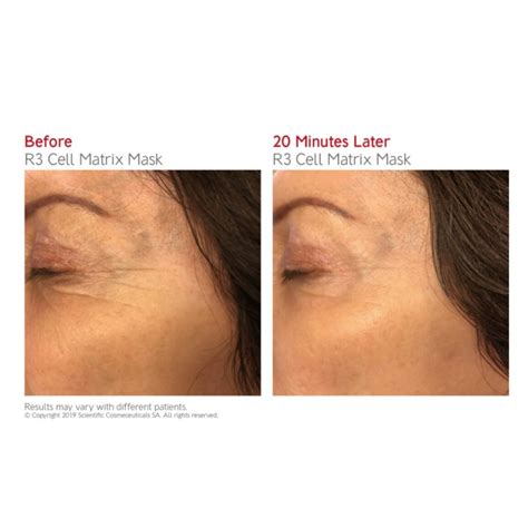 Dr Levy R3 Cell Matrix Mask Switzerland Skin Rejuvenation Uk