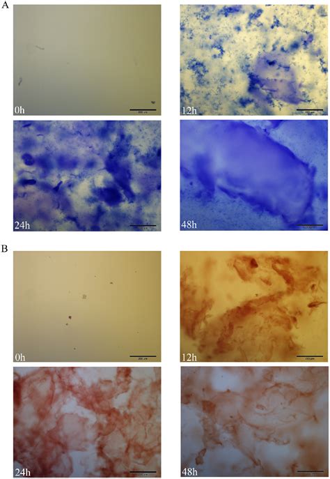 Figure 1 From A Self Assembling Peptide As A Model For Detection Of Colorectal Cancer Semantic