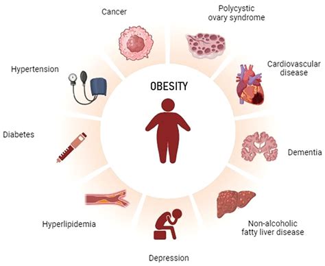 Obesity In Women Hospital Admissions For Obesity More Than Double In