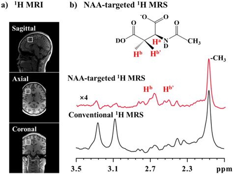 A Routine Mri Images Showing The Voxel Position In The Human Brain Download Scientific