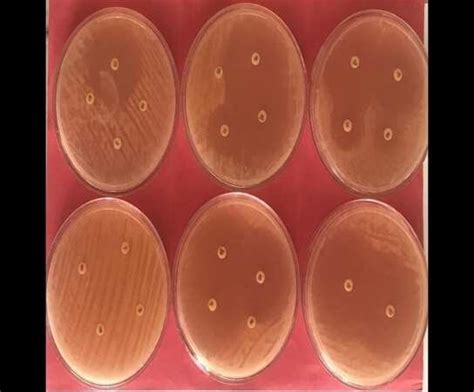 Disc Diffusion Method Of Antimicrobials Susceptibility Test Of Rmucosa