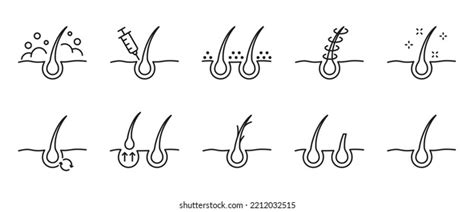 Scalp Problem 3961개가 넘는 로열티 프리 라이선스 대상 스톡 일러스트 및 그림 Shutterstock