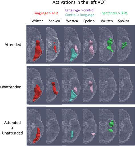 E Ventral View Of Activations Restricted To The Left Ventral Download Scientific Diagram
