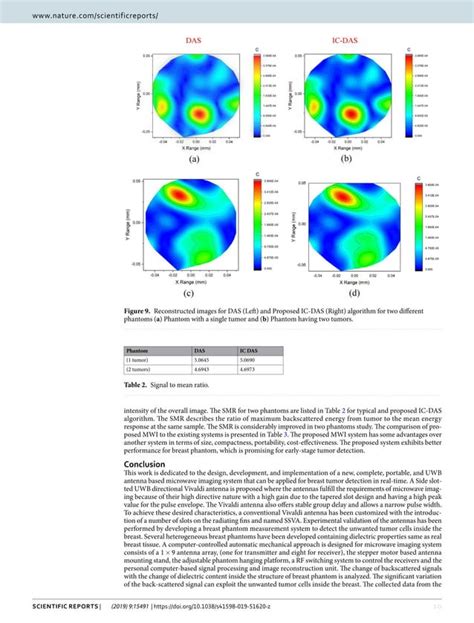 A Low Cost And Portable Microwave Imaging System For Breast Tumor Detection Using Uwb