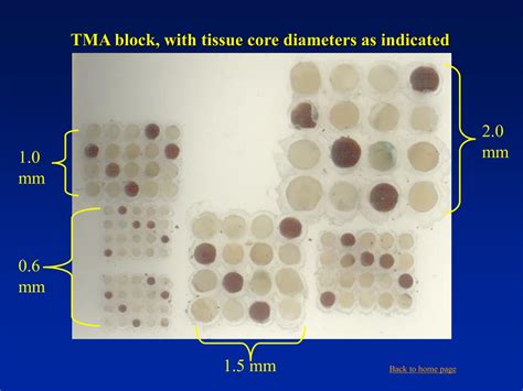 Ppt Requirements For Good Tissue Microarray Tma Results Powerpoint Presentation Id 4513355