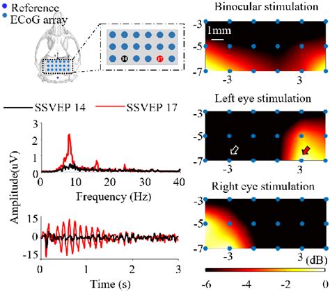 The Brain Activation Mapping Of Ecog Under Different Steadystate Visual Download Scientific