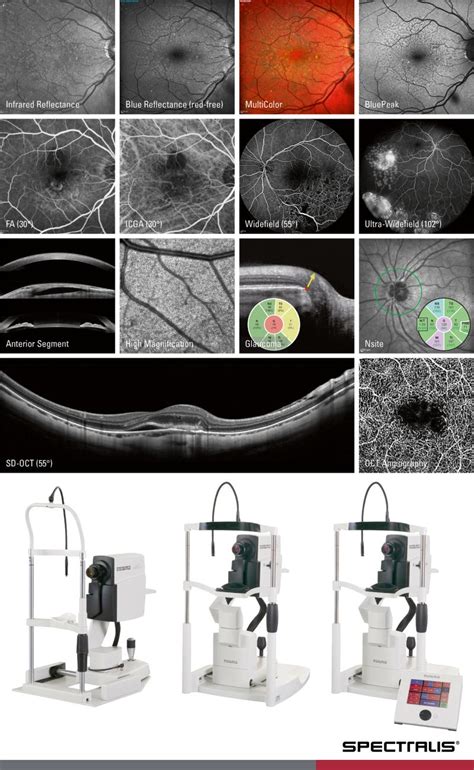 Heidelberg Engineering On Linkedin Spotonspectralis Spectralis Multimodalimaging