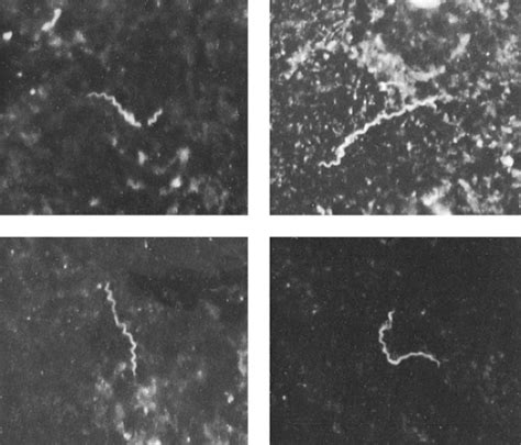 Lymphogranuloma Venereum Lymphadenitis Basicmedical Key