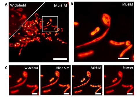 Mai Sim Interferometric Multicolor Structured Illumination Microscopy For Everybody Charles