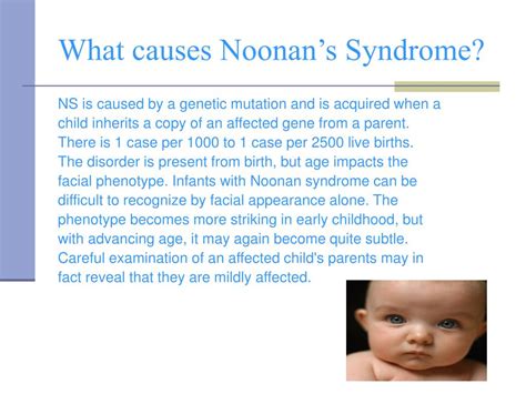 Noonan Syndrome Symptoms Causes Diagnosis Treatment Fmyrx