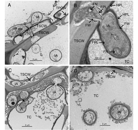 A Puccinia Horiana In Chrysanthmum Passing Through The Cell Walls Of