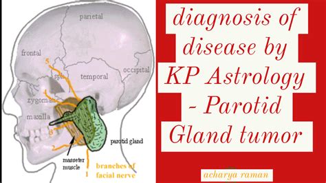 Parotid Gland Tumour Disease By Kp Astrology Acharya Raman And Vgr