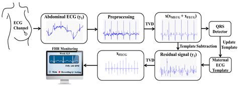The Importance Of A Fetal Electrocardiogram Database