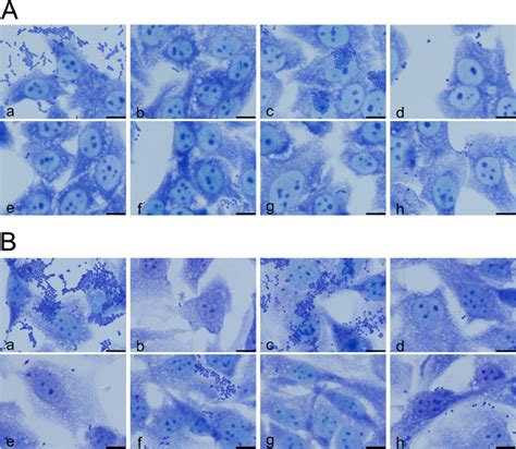 Localized Adherence Pattern Of Ehec Isolates From Hospitalized Patients Download Scientific