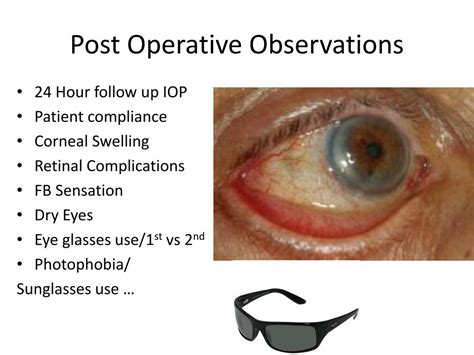 Laser Cataract Surgery Post Op Instructions At Genevieve Tarrant Blog