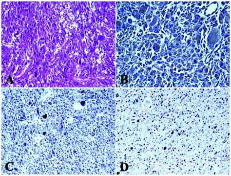 A High Power Photomicrograph Showing Proliferation Of Pleomorphic Download Scientific Diagram
