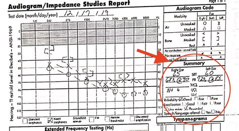 Understanding Audiograms And Speech Recognition Testing