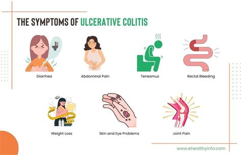 Ulcerative Colitis Symptoms Causes Treatment And More