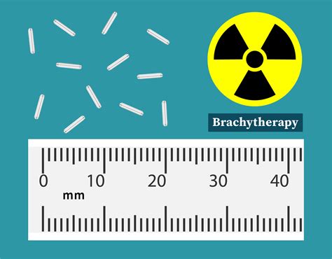 Low Dose Rate Brachytherapy