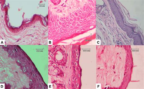Epidermal Thickness In A No Uvb Exposure B Chronic Uvb Exposure C Download Scientific