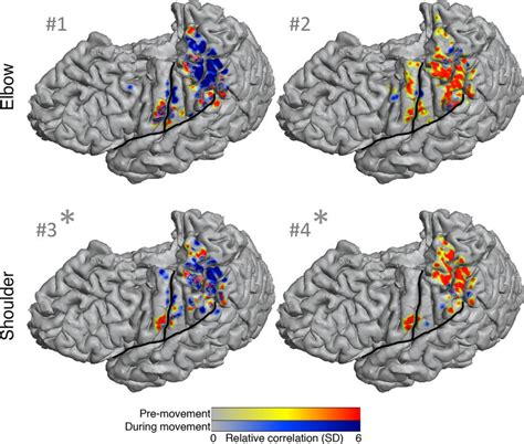 Spatiotemporal Patterns Of Cortical Activity Linked To Muscle Download Scientific Diagram