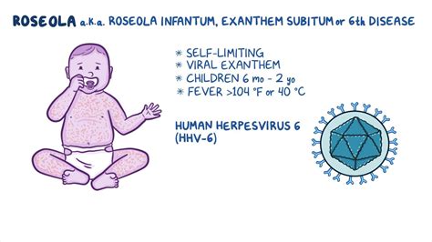Exanthem Subitum Drug Induced Vs Viral Maculopapular