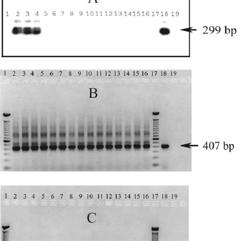 Enumeration Of Pseudomonas Chlororaphis Rn L11 In Compost Microcosms