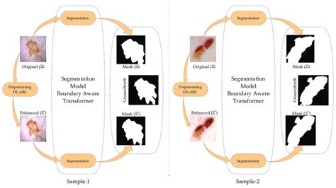 De Abc Preprocessing Effects On Comprehensive Attention Cnn
