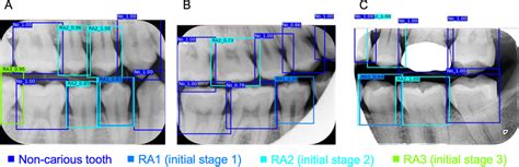 Samples Of Bitewing Radiographs Showing Yolov3 Predicted Classification Download Scientific