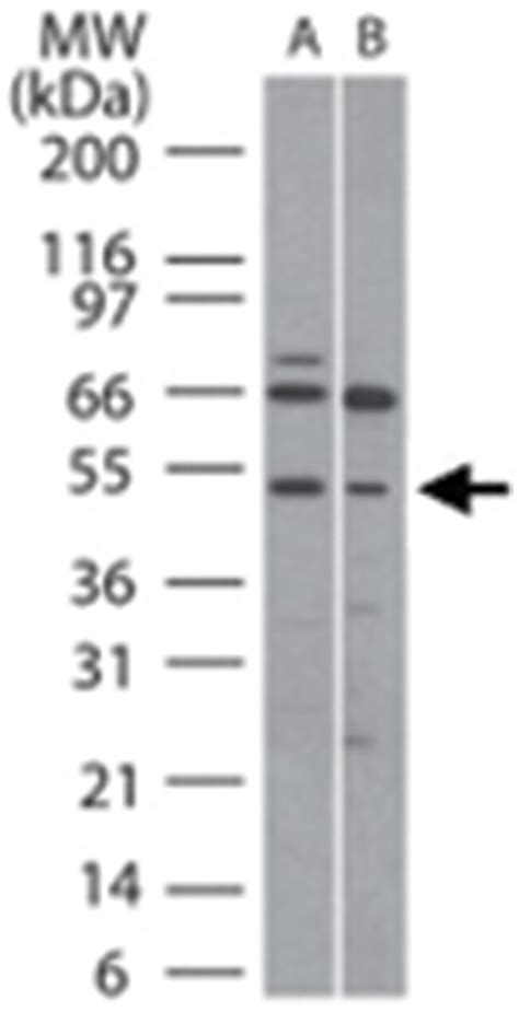 Anti Runx1 Antibody 100ug