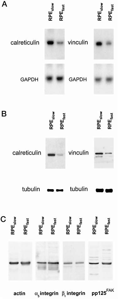 Differential Expression Of Calreticulin Is Accompanied By A Download Scientific Diagram
