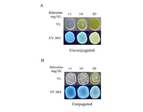 The Appearance Of Serum Containing Elevated Levels Of Unconjugated Or Download Scientific