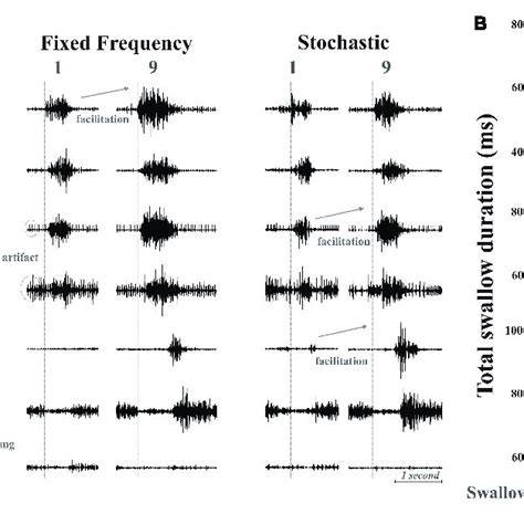 Example Trial Of The Stochastic Electrical Stimulation Condition Download Scientific Diagram