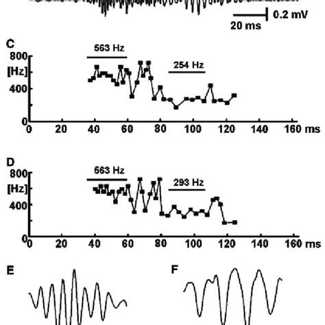 Interspike Interval And Cycle Width And Waveform Shape Contribute To Download Scientific