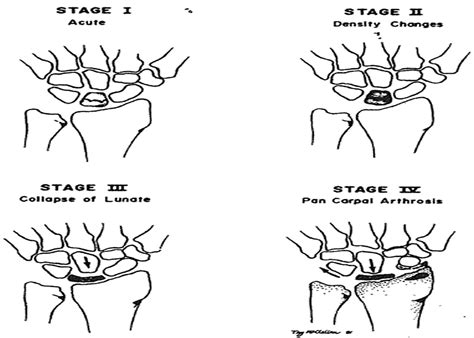 Clinical Orthopaedics And Related Research®
